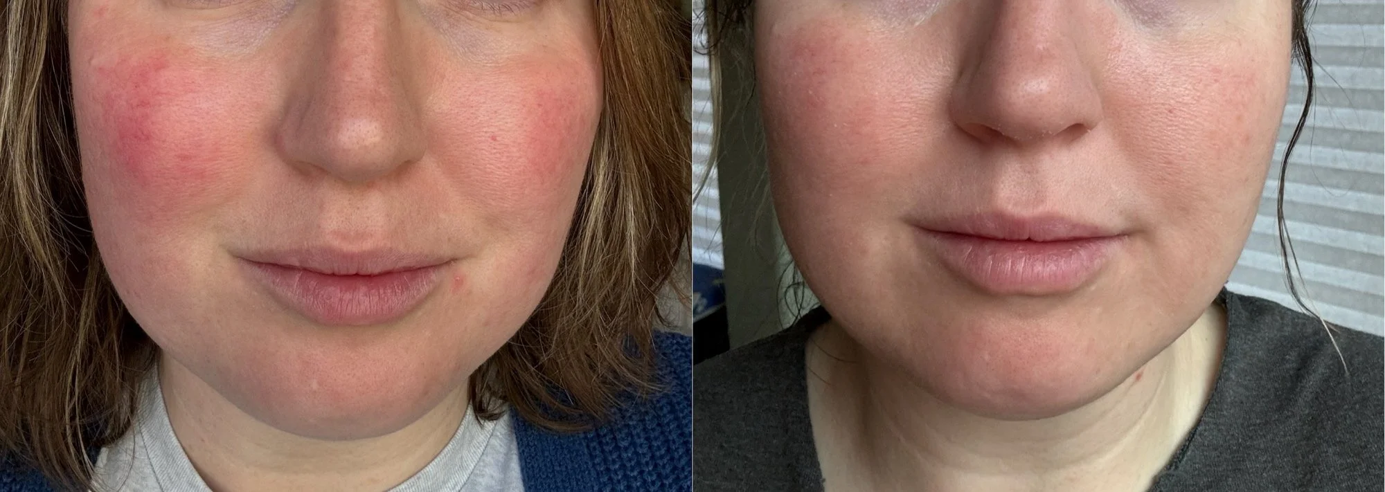 Curated Skin Programs Tailored to Your Needs — Emerald Aesthetics