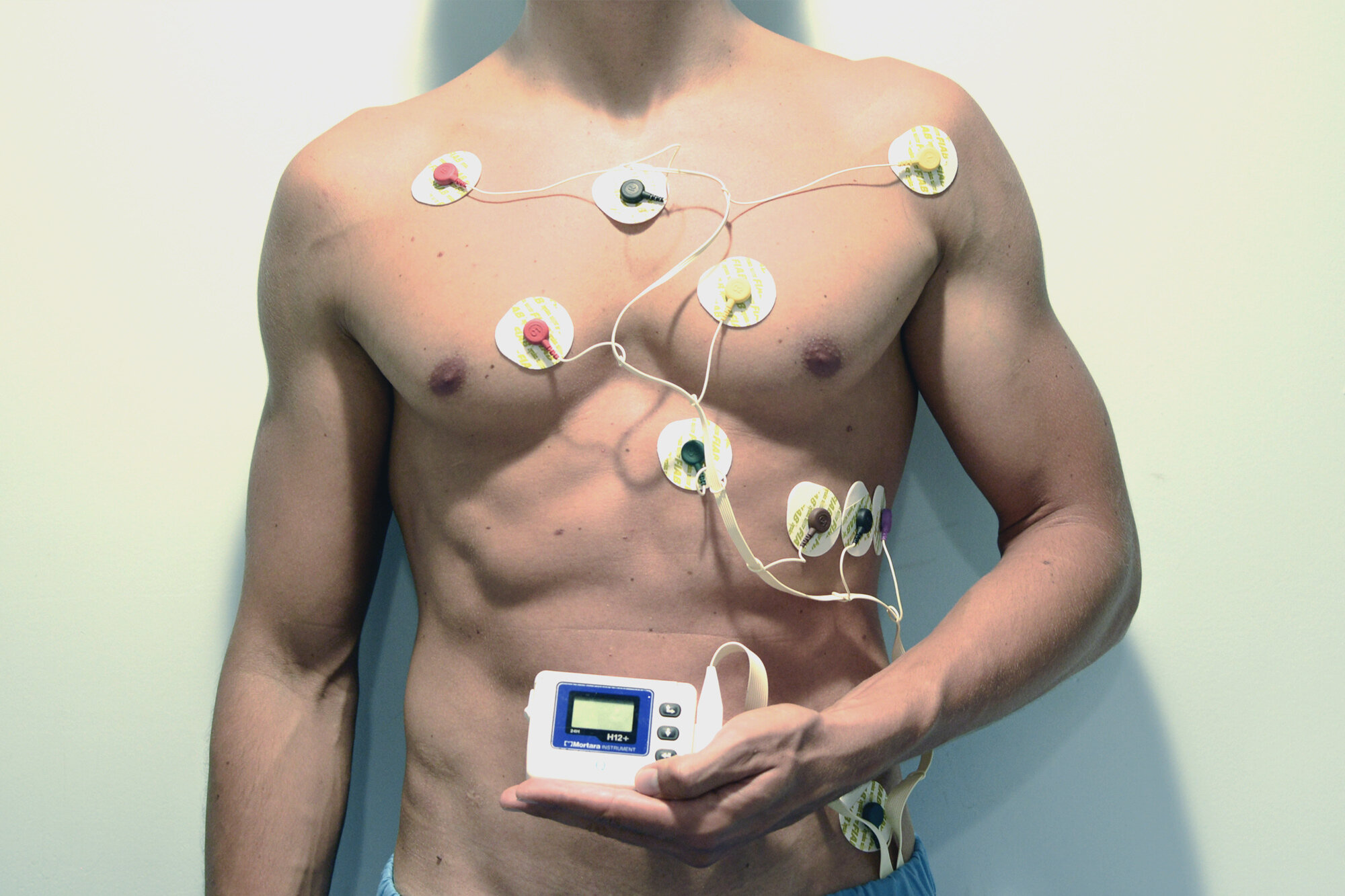 L’Holter Cardiaco delle 24h — Luca Arioli