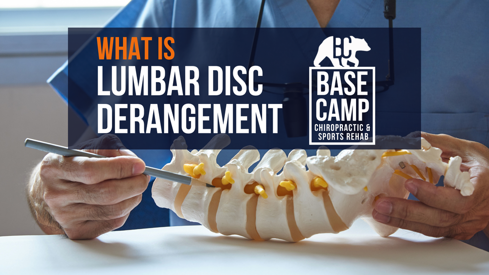 What is lumbar disc derangement? — Sports Chiropractor Vernon BC