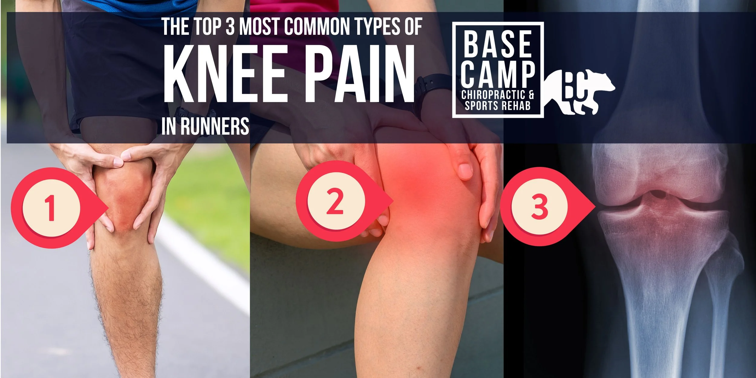 DO YOU KNOW the 3 MOST COMMON types of Knee Pain in Runners? — Base ...