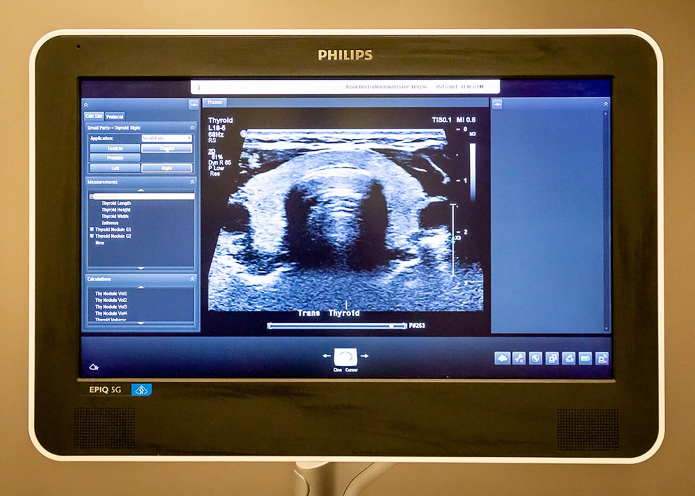General Ultrasound | Associated Radiologists LLP