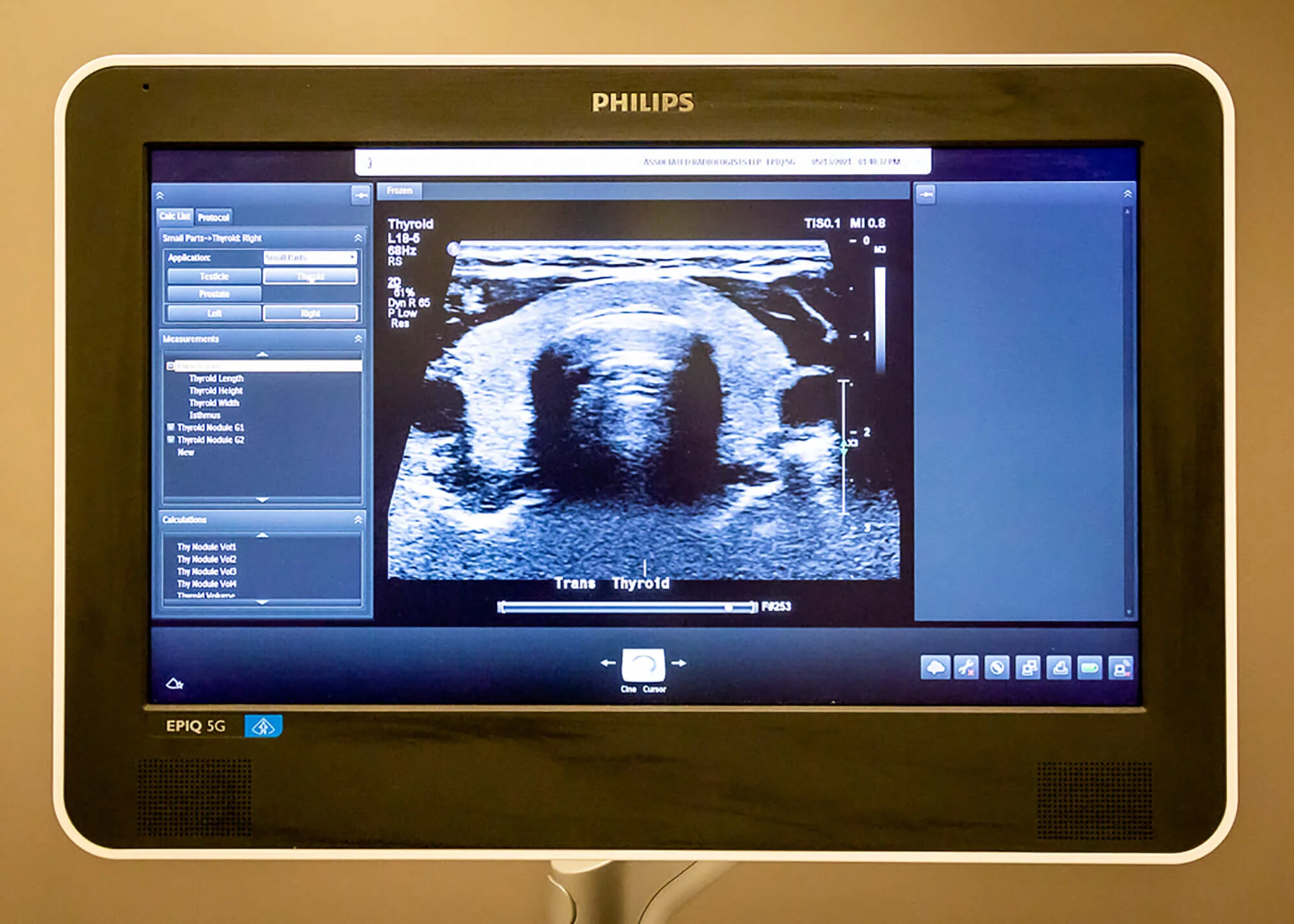 General Ultrasound | Associated Radiologists LLP