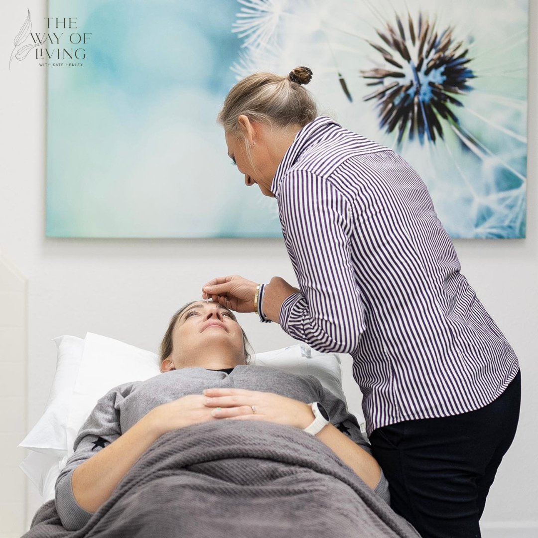 What is Acupuncture? — The Way of Living