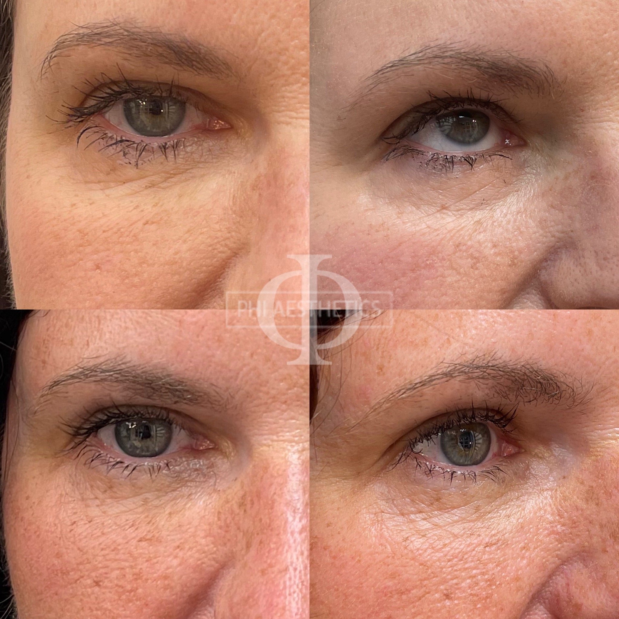 Services 3 — PHI AESTHETICS