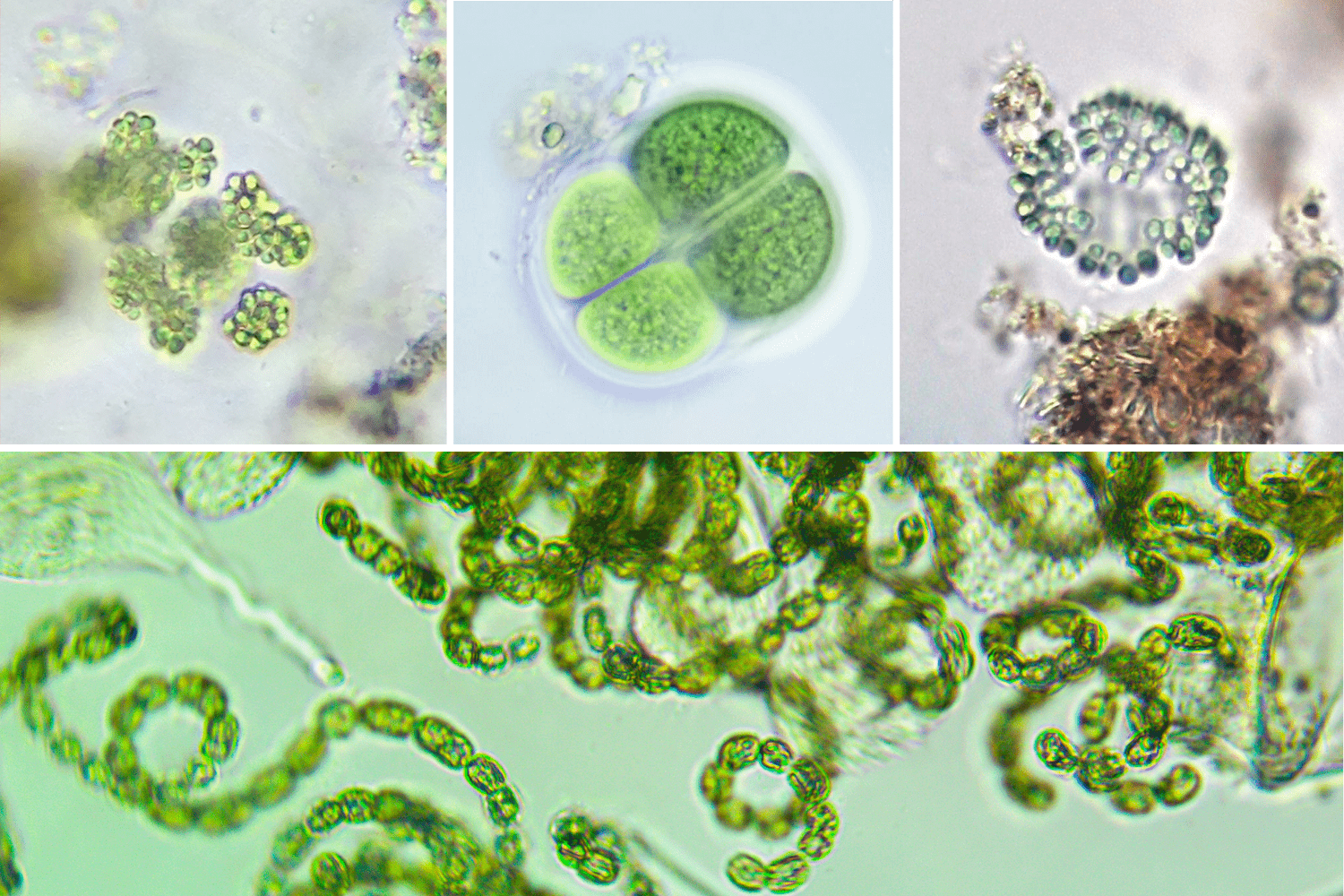 Tiny Plankton Could Play Big Role in Monitoring Marine Health — The ...