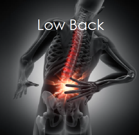 Wellness Program for your Low Back — Deliver PT
