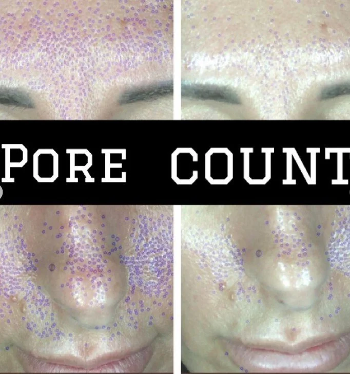 Looking Beneath the Surface — 1192 Laser & Beauty Clinic