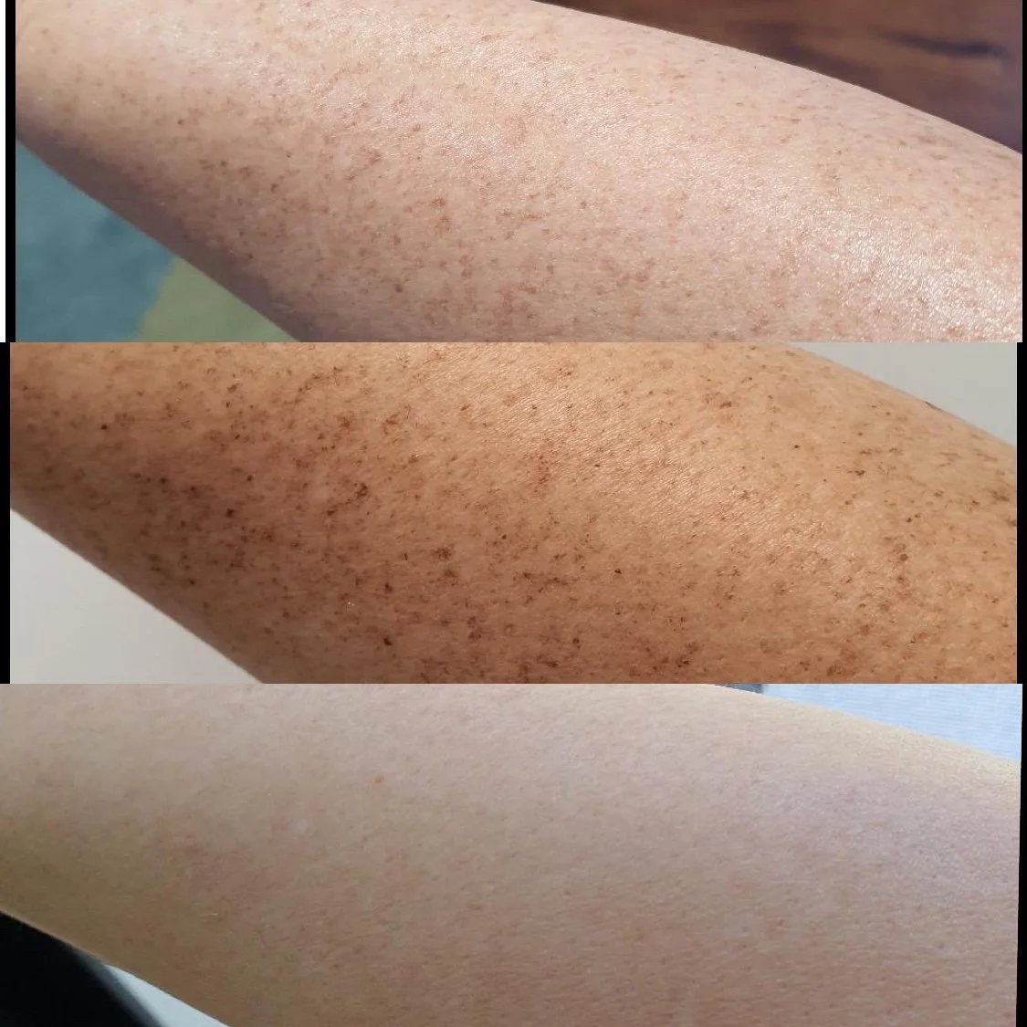 PÜRE SKIN + CLINIC