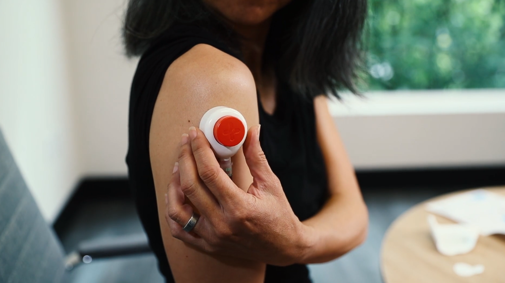 TASSO+ KIT — Tasso, Inc.