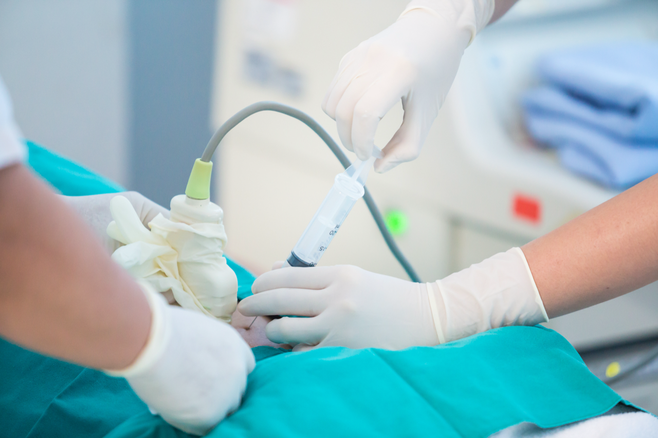 Amniocentesis & CVS — Women's Scan Room