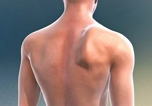 Neutral shoulder blade position and its importance — CENTRAL PHYSICAL ...