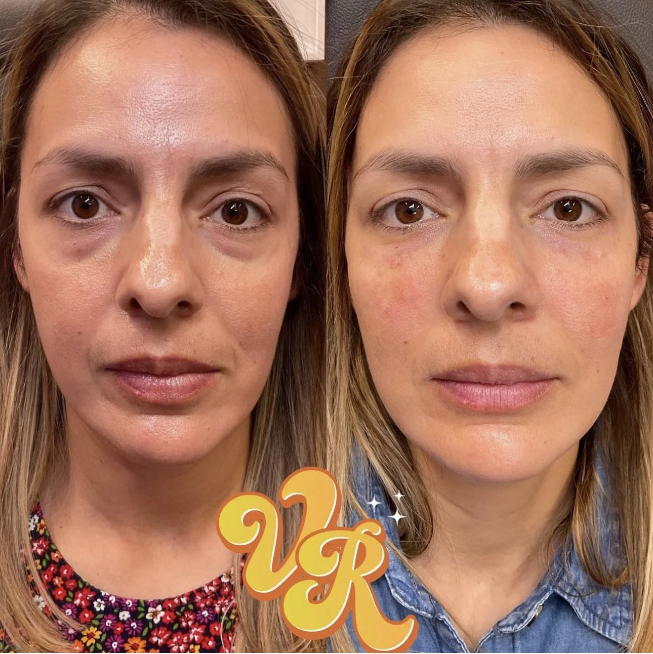 The Vanity Room Med Spa in Orlando, FL