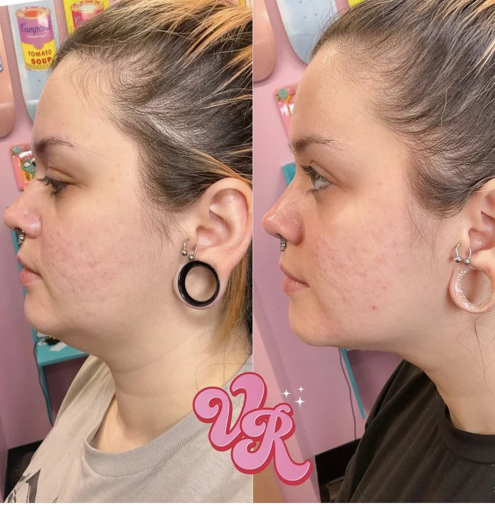 The Vanity Room Med Spa in Orlando, FL