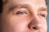 Chalazion vs. Stye: What’s the Difference & Treatment Options ...