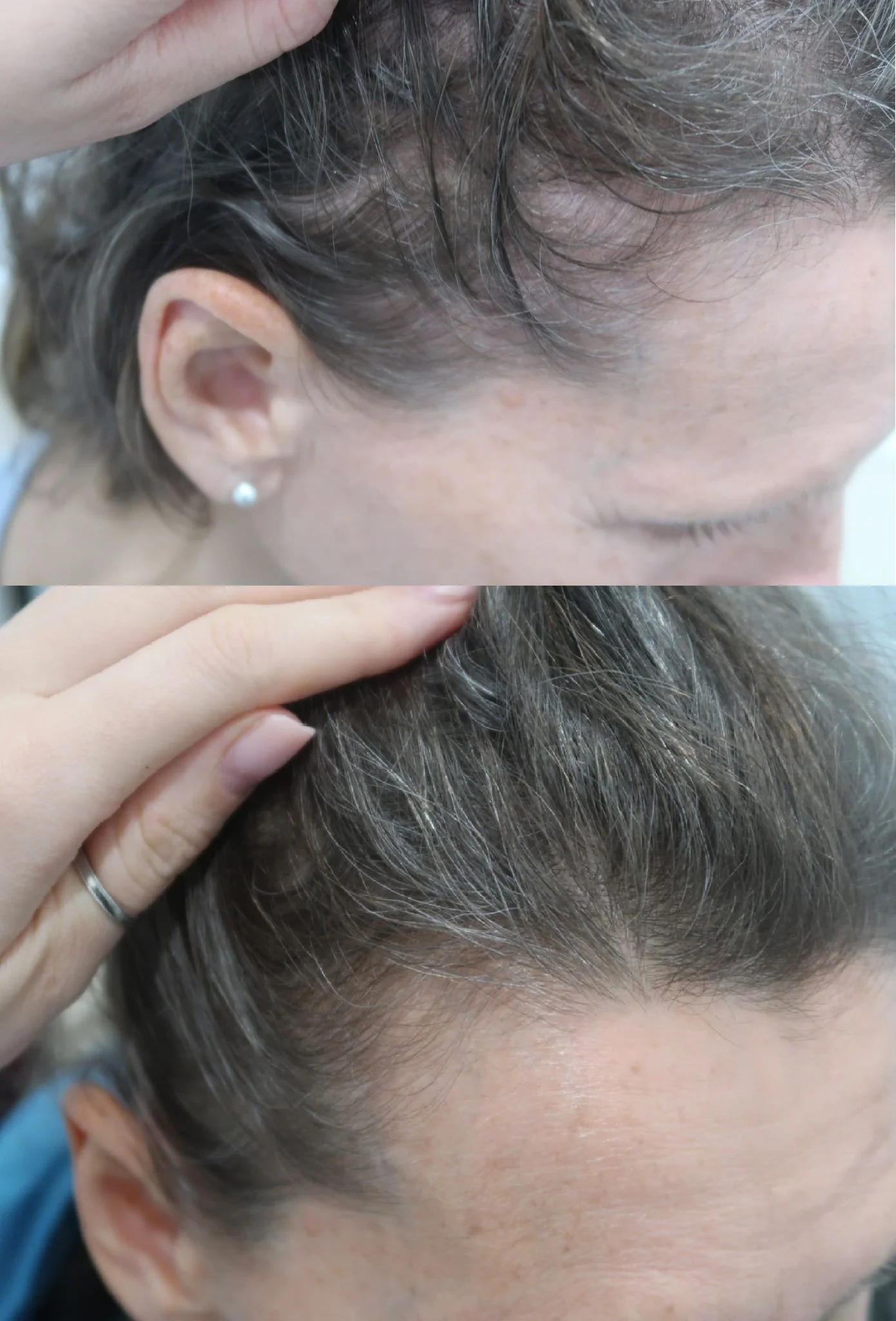 Hair Journey Before & After Photos. Our Gallery