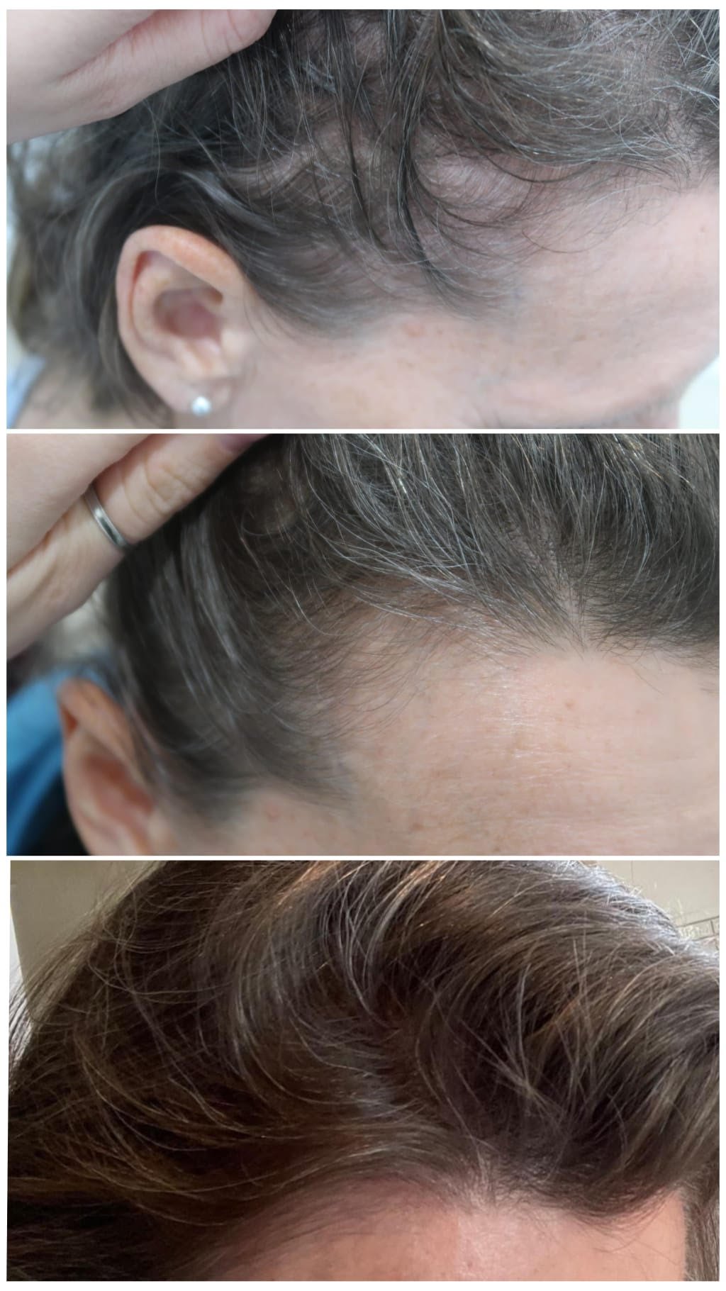 Hair Journey Before & After Photos. Our Gallery