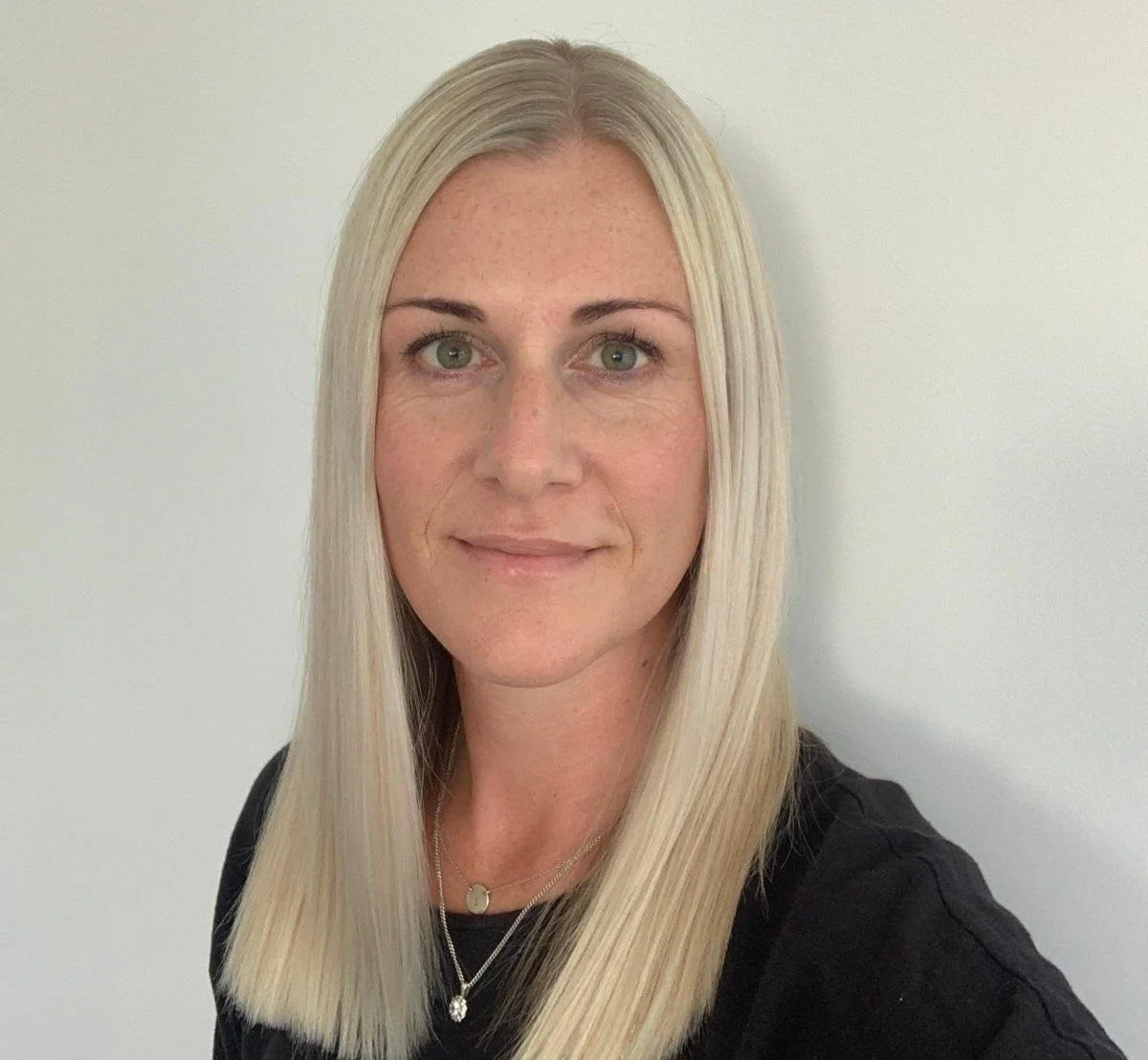 Our Vision & Team | Best Treatment for Hair Loss & Regrowth