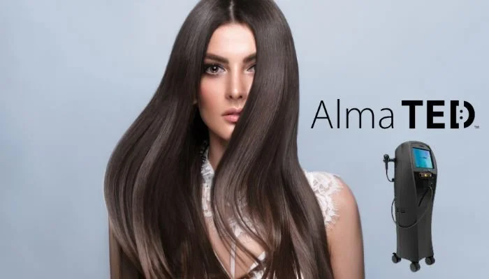 Alma TED Non-Invasive Hair Restoration - The Hair Clinic
