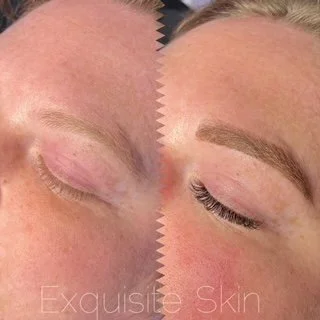 Exquisite Skin