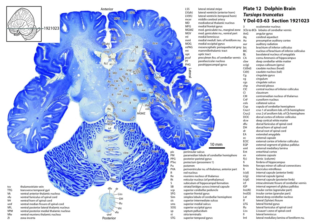 Atlas of the Brain of a Dolphin — Comparative Brain Anatomy