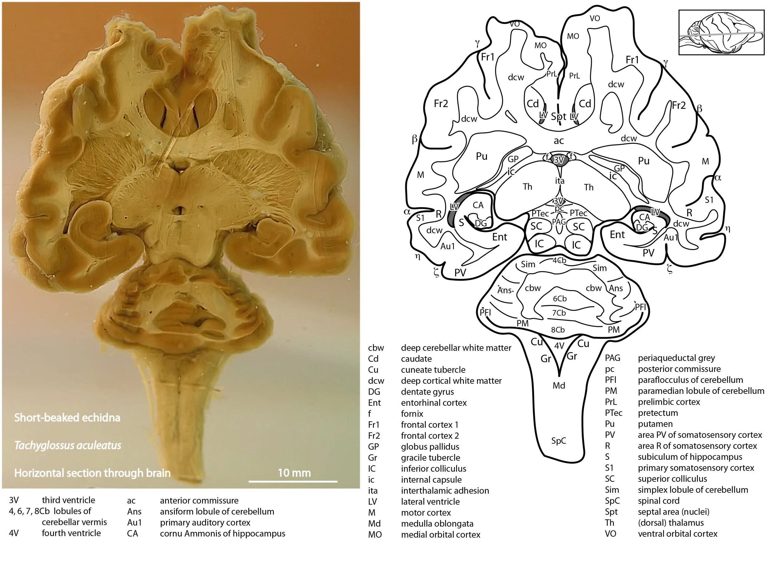 Short-beaked echidna brain — Comparative Brain Anatomy