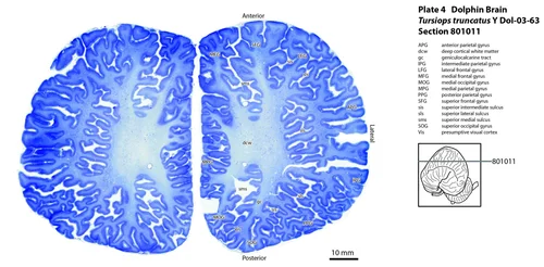 Atlas of the Brain of a Dolphin — Comparative Brain Anatomy