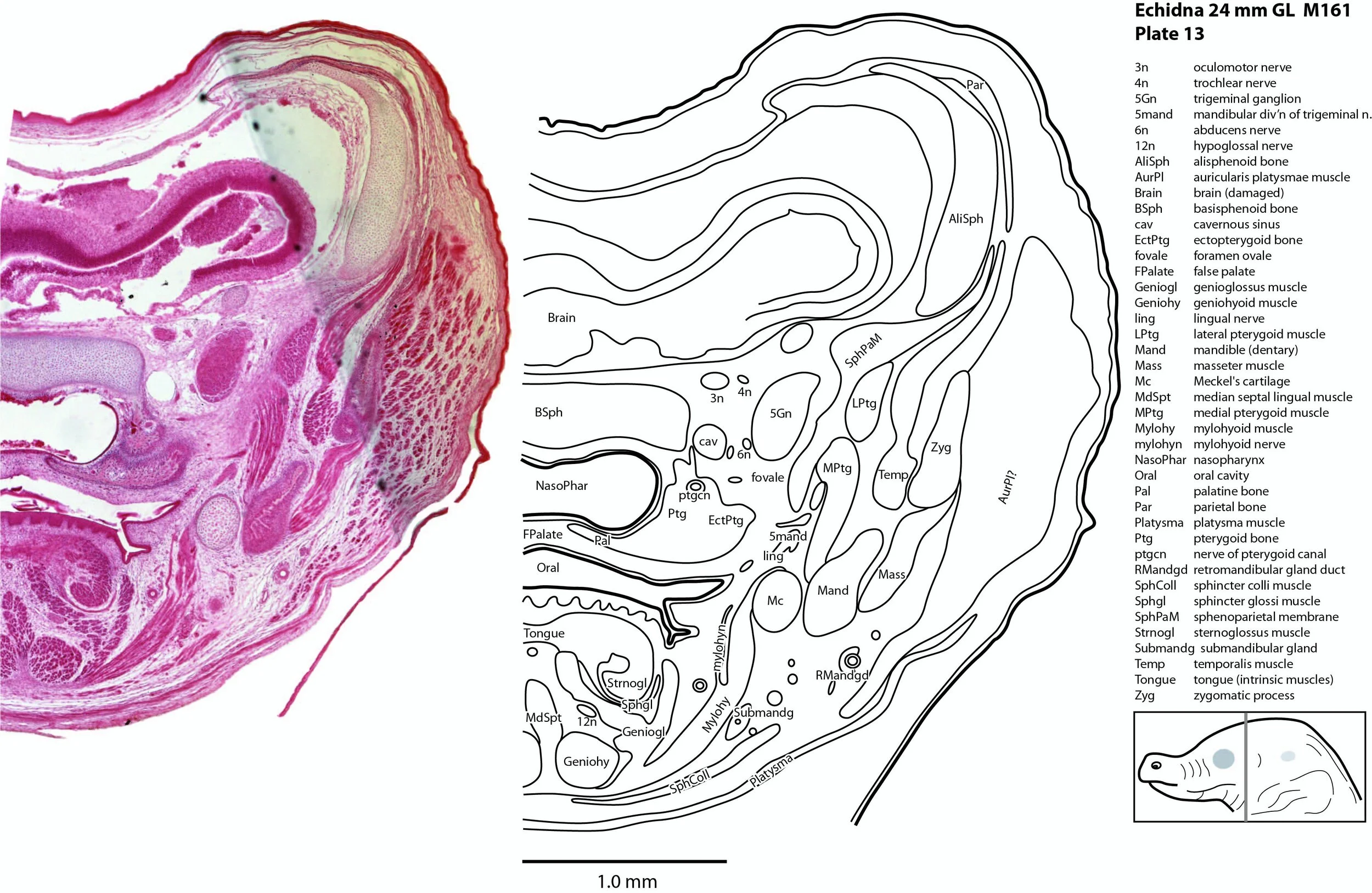 Echidna 24 mm GL (hatchling) — Comparative Brain Anatomy