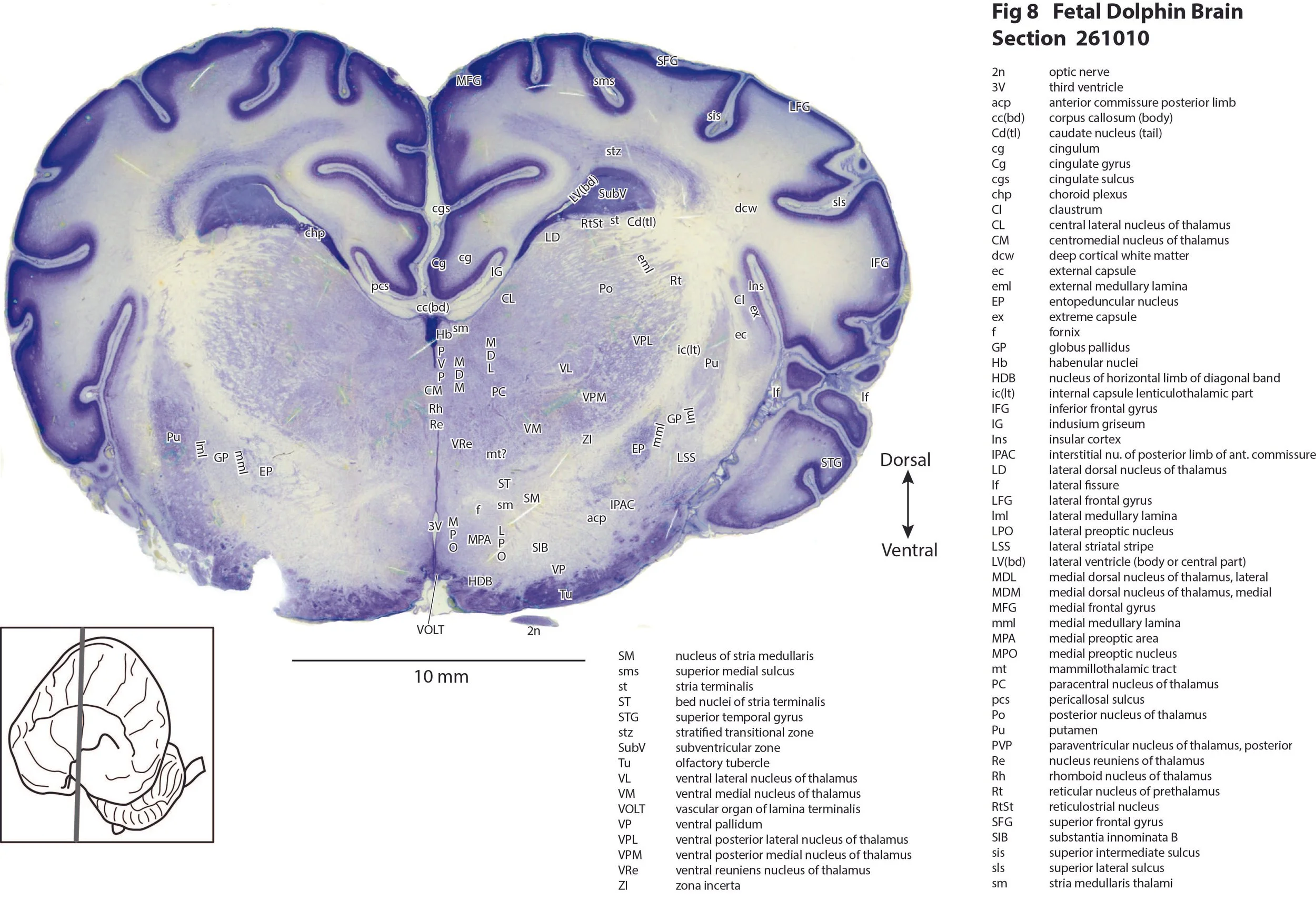 Atlas of the Brain of a Fetal Dolphin — Comparative Brain Anatomy