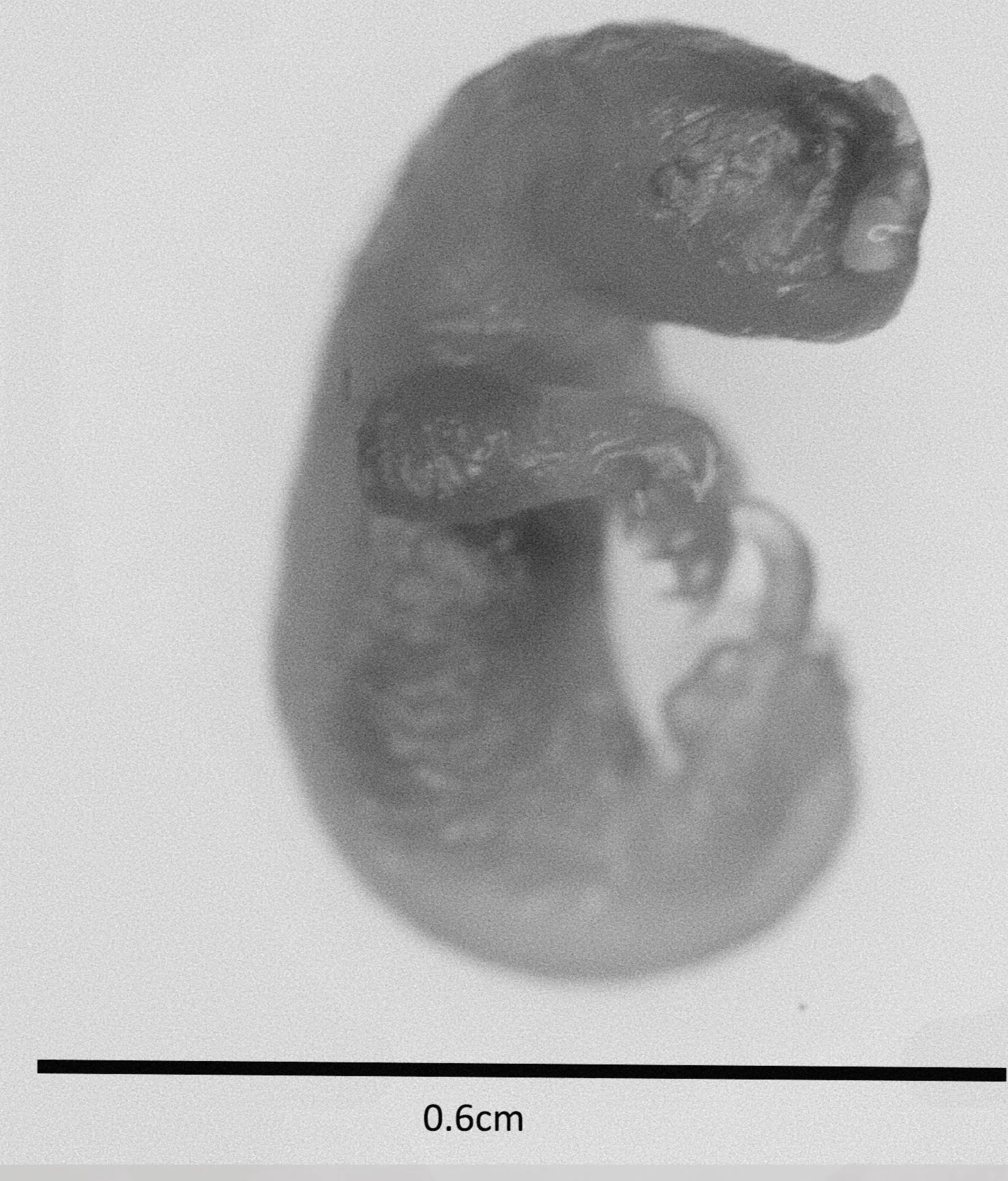 Development of Monito del Monte — Comparative Brain Anatomy