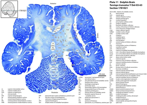 Atlas of the Brain of a Dolphin — Comparative Brain Anatomy