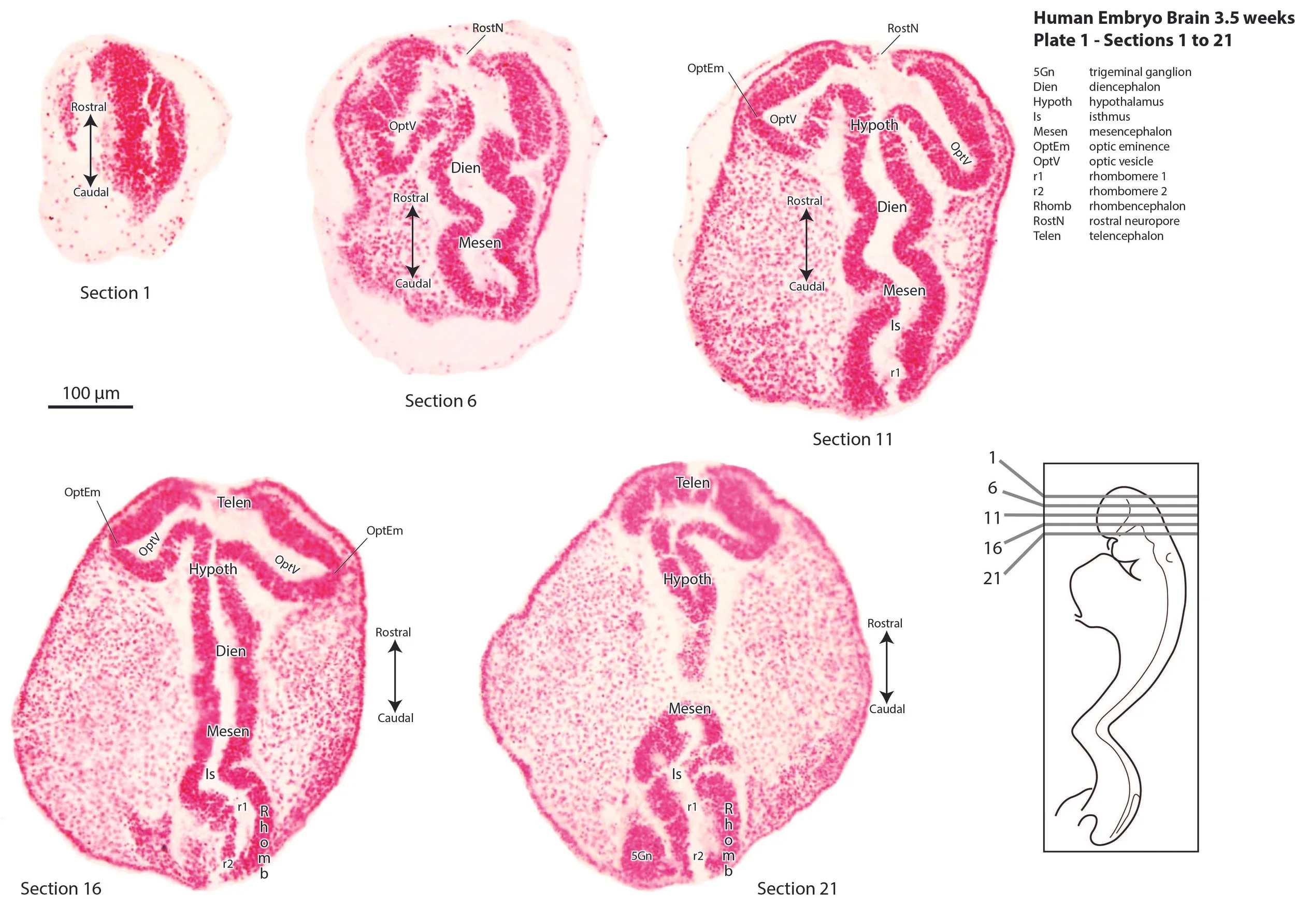 Human Embryo 3.5 weeks — Comparative Brain Anatomy