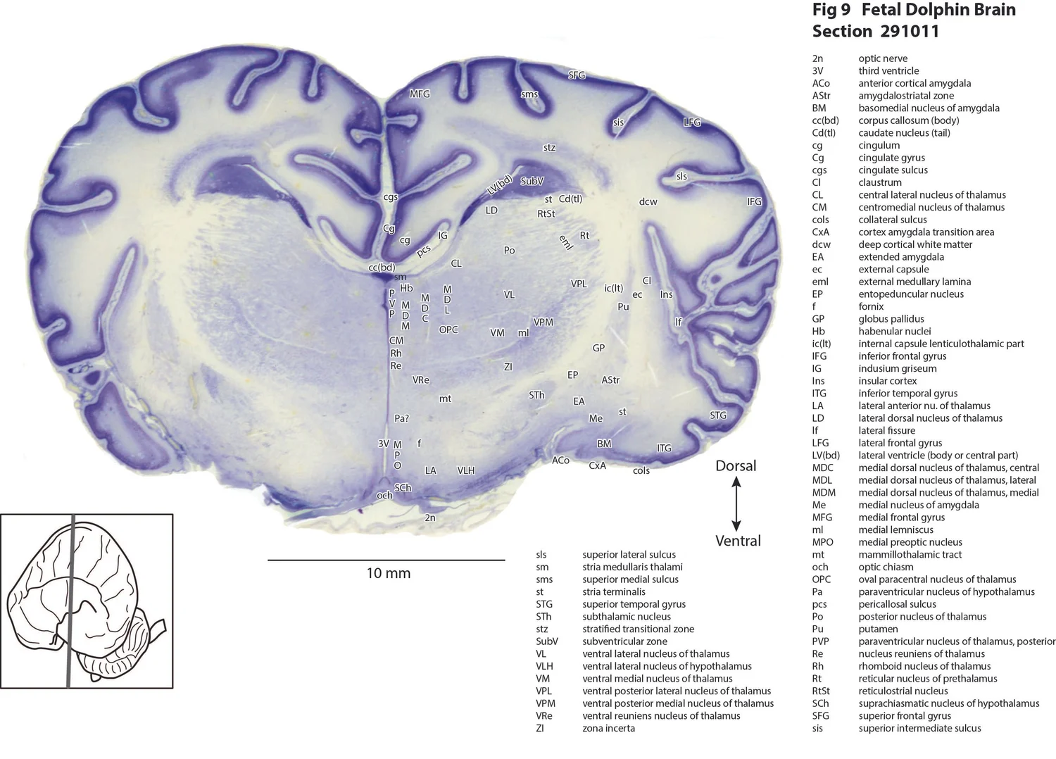Atlas of the Brain of a Fetal Dolphin — Comparative Brain Anatomy