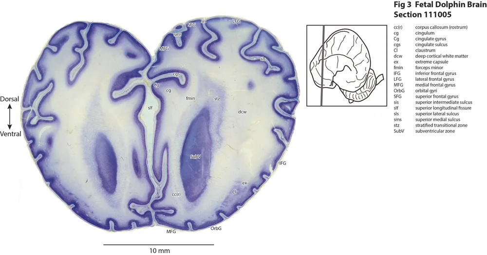 Atlas of the Brain of a Fetal Dolphin — Comparative Brain Anatomy
