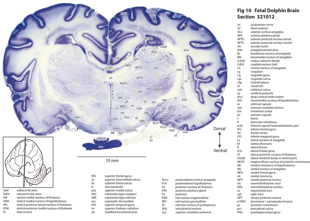 Atlas of the Brain of a Fetal Dolphin — Comparative Brain Anatomy