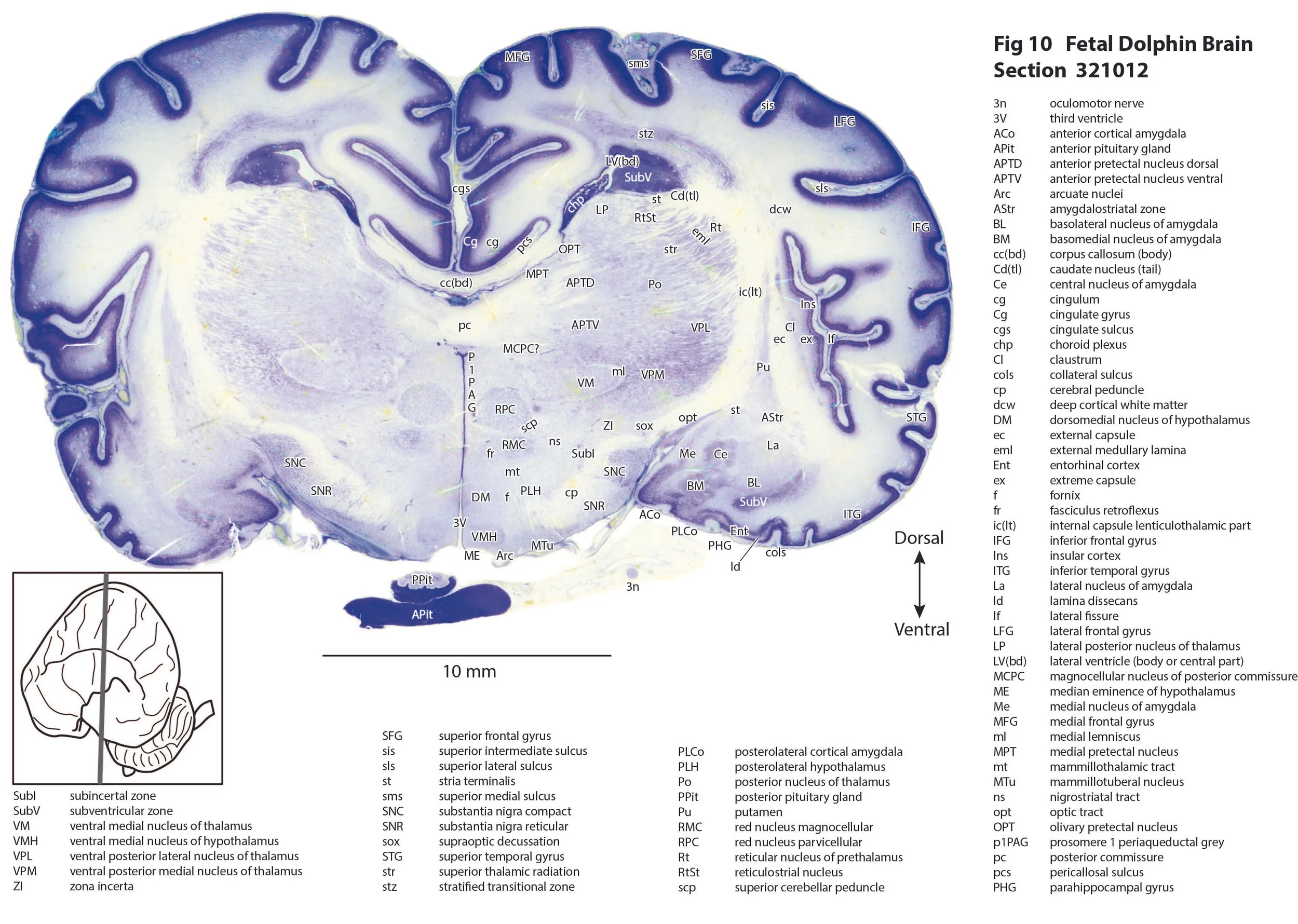 Atlas of the Brain of a Fetal Dolphin — Comparative Brain Anatomy