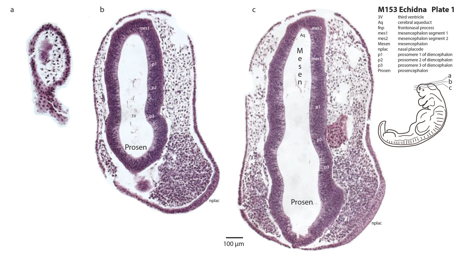Echidna 7.4 mm GL (incubation) — Comparative Brain Anatomy