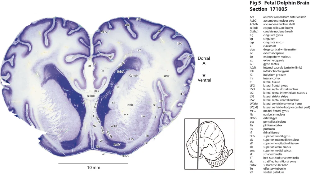 Atlas of the Brain of a Fetal Dolphin — Comparative Brain Anatomy