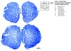 Atlas of the Brain of a Dolphin — Comparative Brain Anatomy