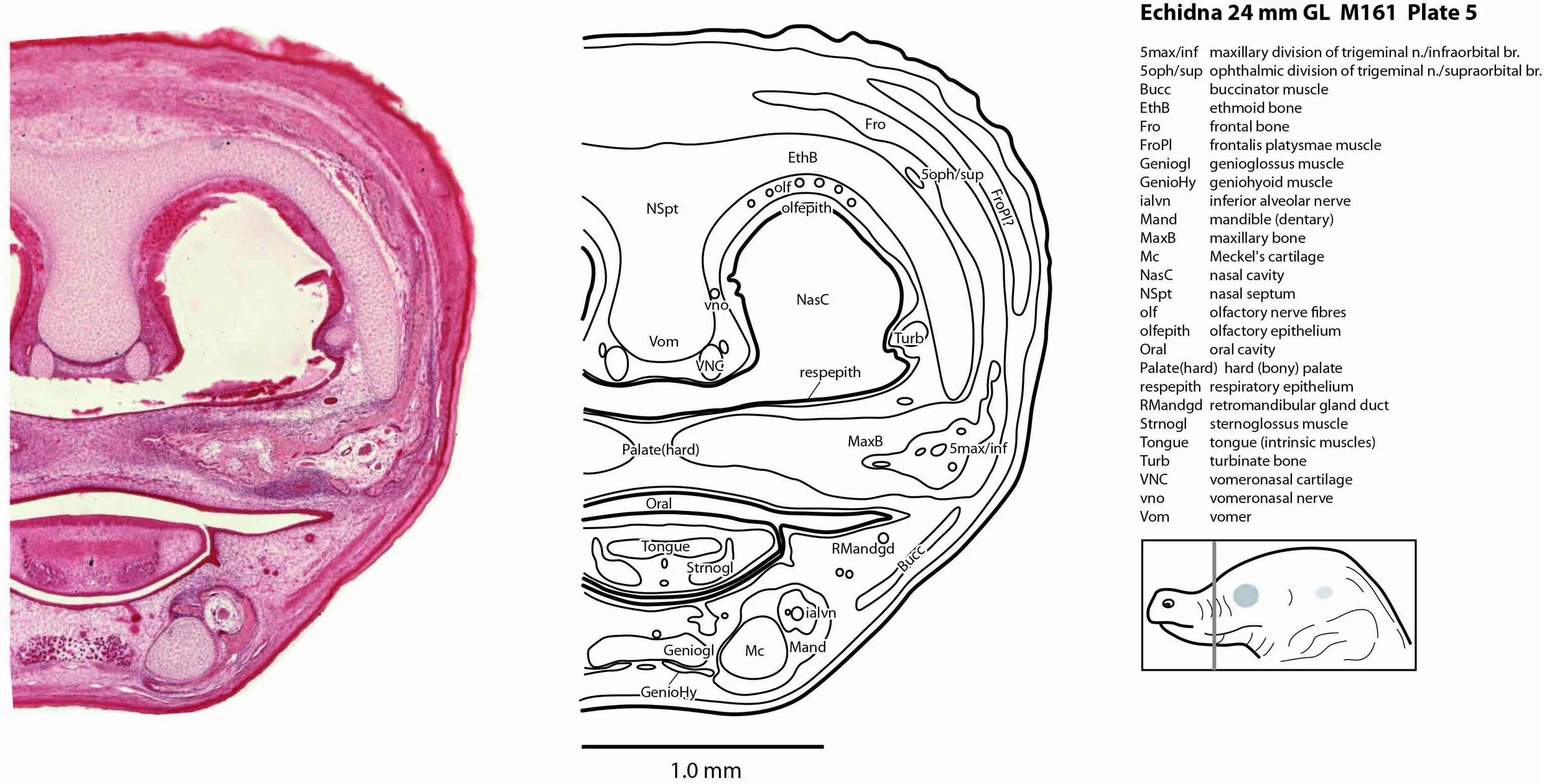 Echidna 24 mm GL (hatchling) — Comparative Brain Anatomy