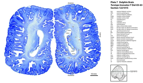 Atlas of the Brain of a Dolphin — Comparative Brain Anatomy