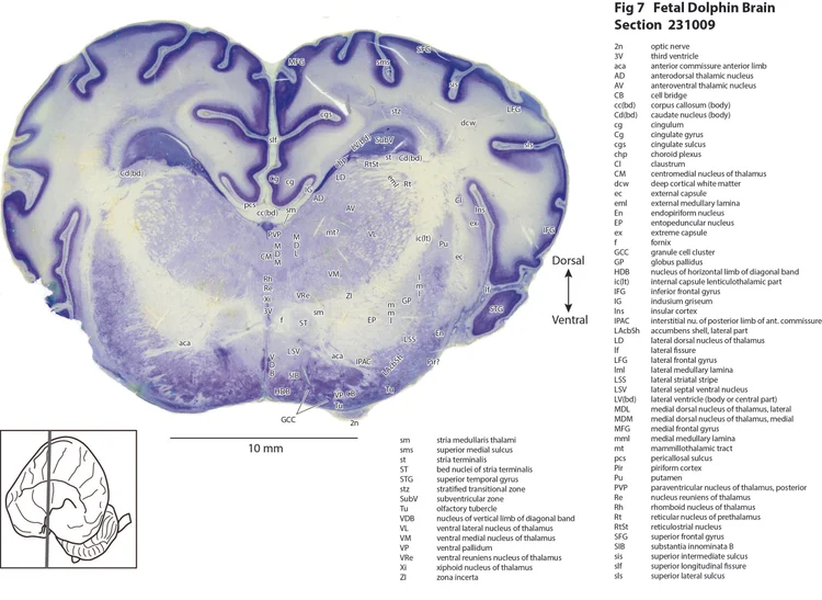 Atlas of the Brain of a Fetal Dolphin — Comparative Brain Anatomy