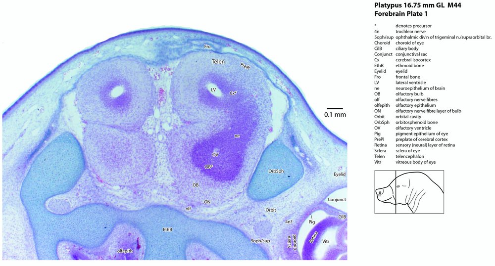 Platypus 16.75 mm GL Forebrain — Comparative Brain Anatomy