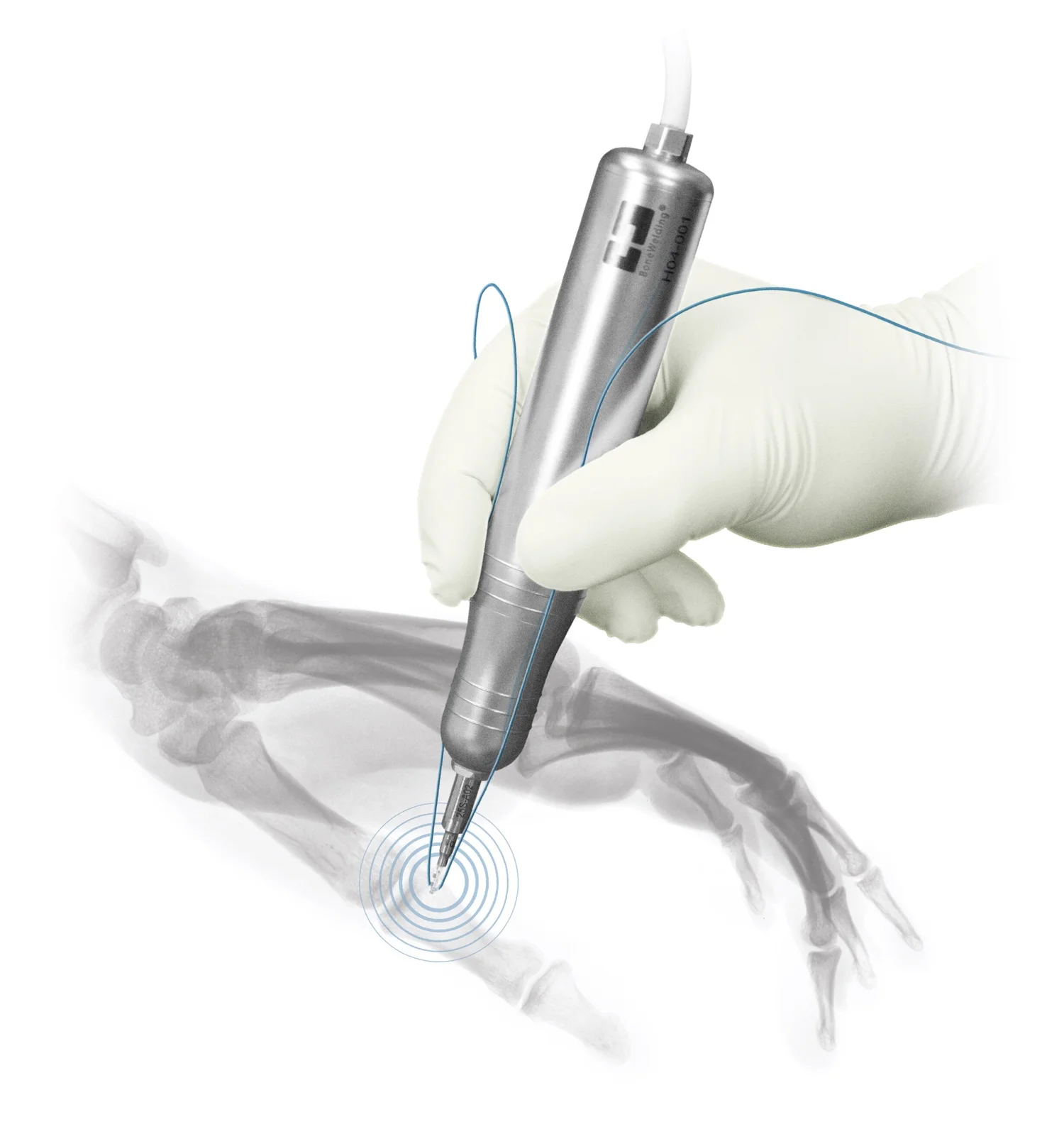 Technology — Surgical Fusion