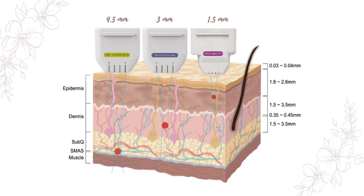 What are the benefits of HIFU Treatment — POCOBEAUTY
