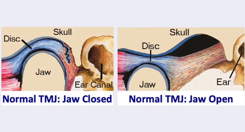 Temporo-Mandibular Joint Disorders — The Jaw Physio