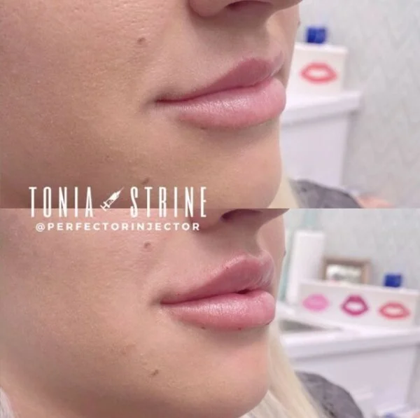 Injectables — GLOW Medical Spa