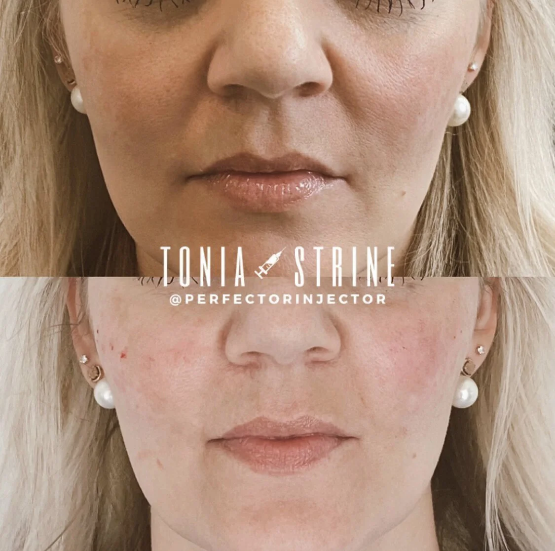 Injectables — GLOW Medical Spa