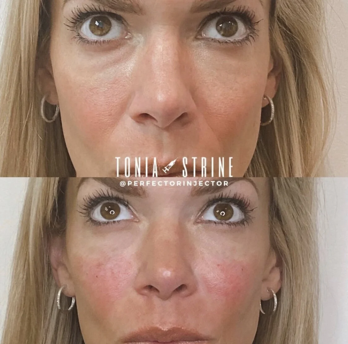 Injectables — GLOW Medical Spa