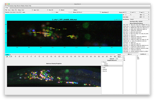 NeuroPAL — Yemini Lab