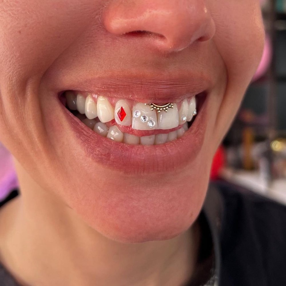 Custom Tooth Gems | Cherry Bomb Studio NYC | Enhance Your Smile Today ...